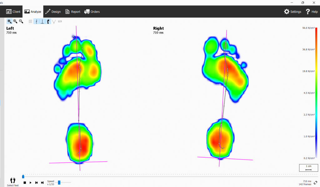 Pop-Up Footscan analysis clinic - One Step Ahead Podiatry