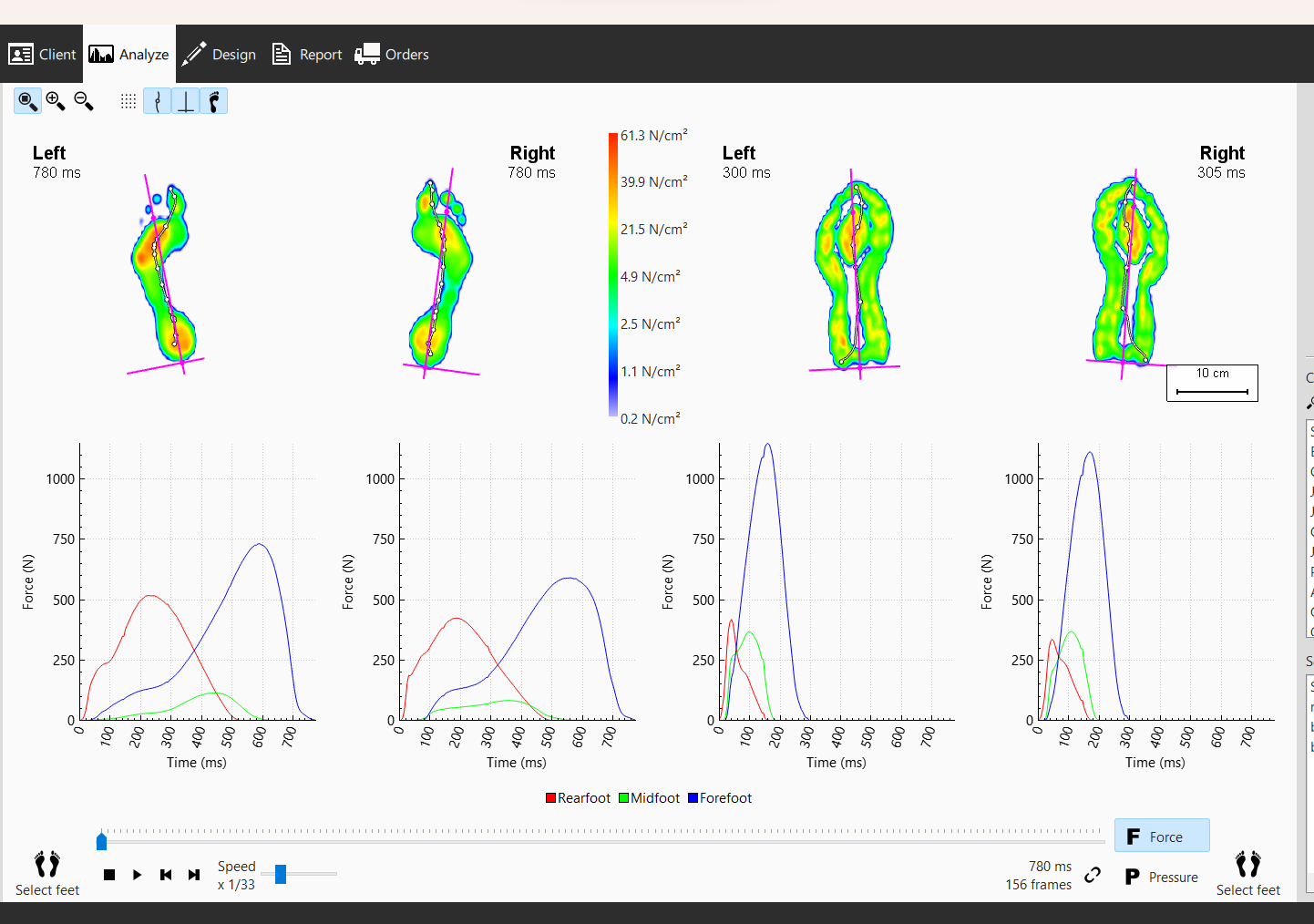 Introducing Phits Orthotics: Revolutionising Foot Health - One Step ...